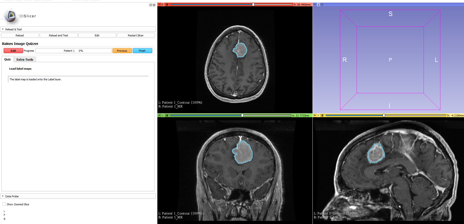 Load Label Maps And Segmentations Image Quizzer Documentation